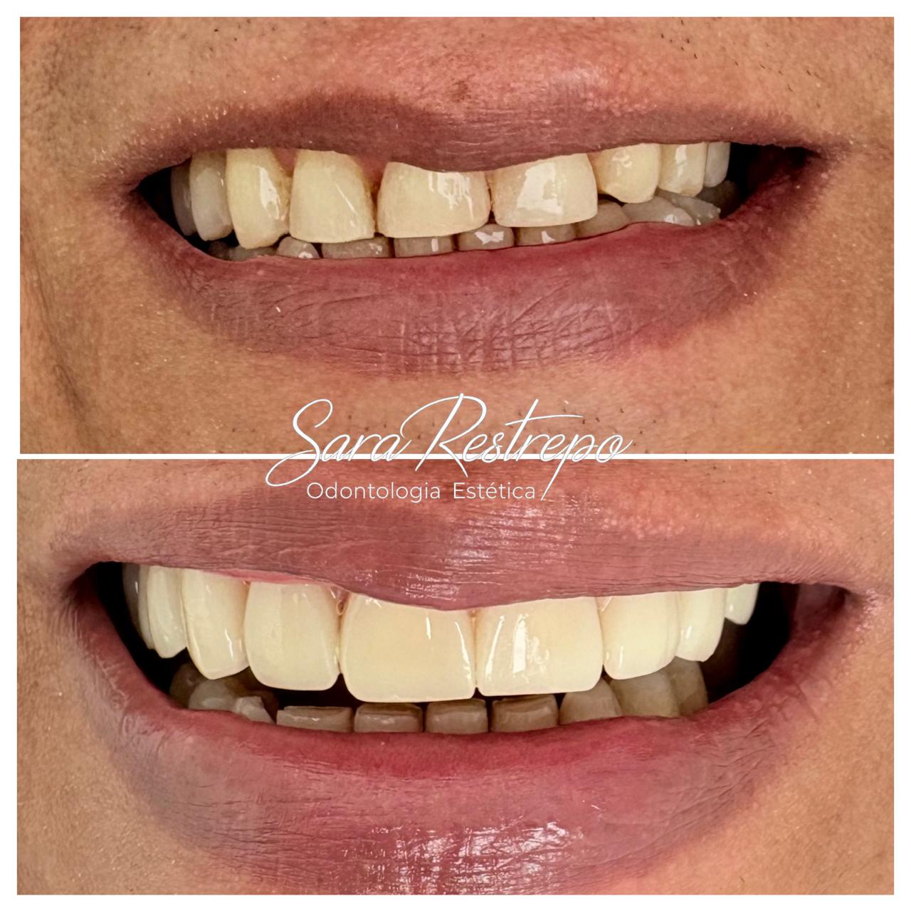 Desing dental in Cali | Dr. Sara Restrepo